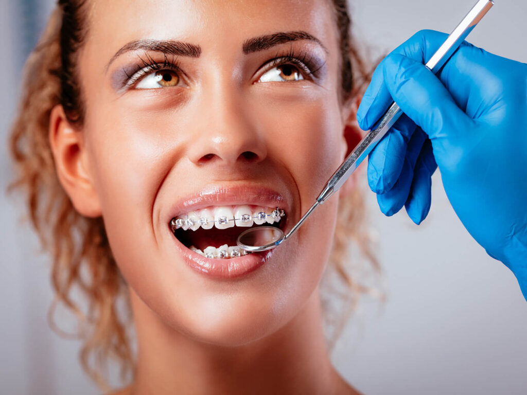 San Antonio Dental Office TX: Get Braces Removal Done