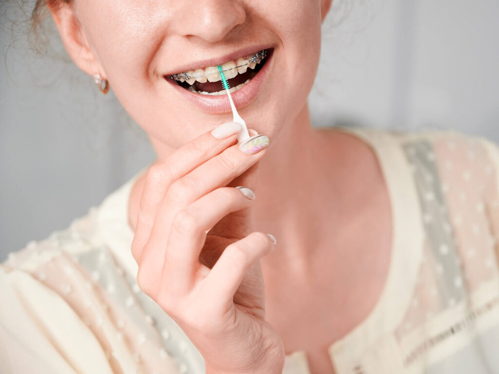 Orthodontic Hygiene Tips: Caring for Your Teeth with San Antonio Dental